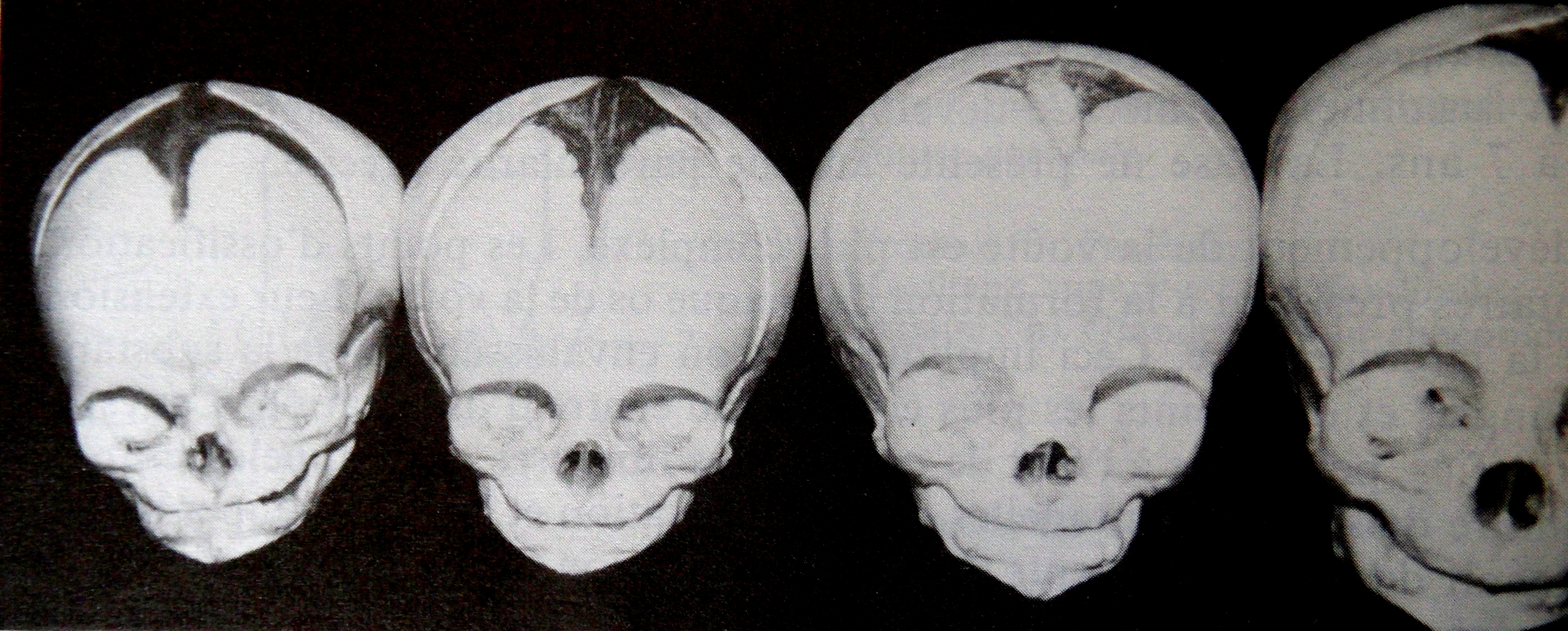 Ostéopathie & nourrisson